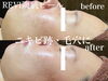 大人のお肌悩み解決 | エステサロンDiarm岸和田カンカン店のニュース | まいぷれ[泉州中央]